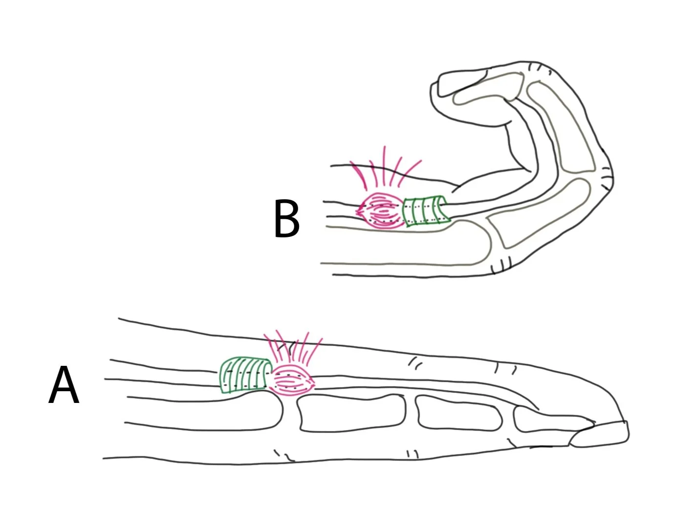 What Causes Trigger Finger? A 5-Step Guide for Patients — Dr. Nick ...