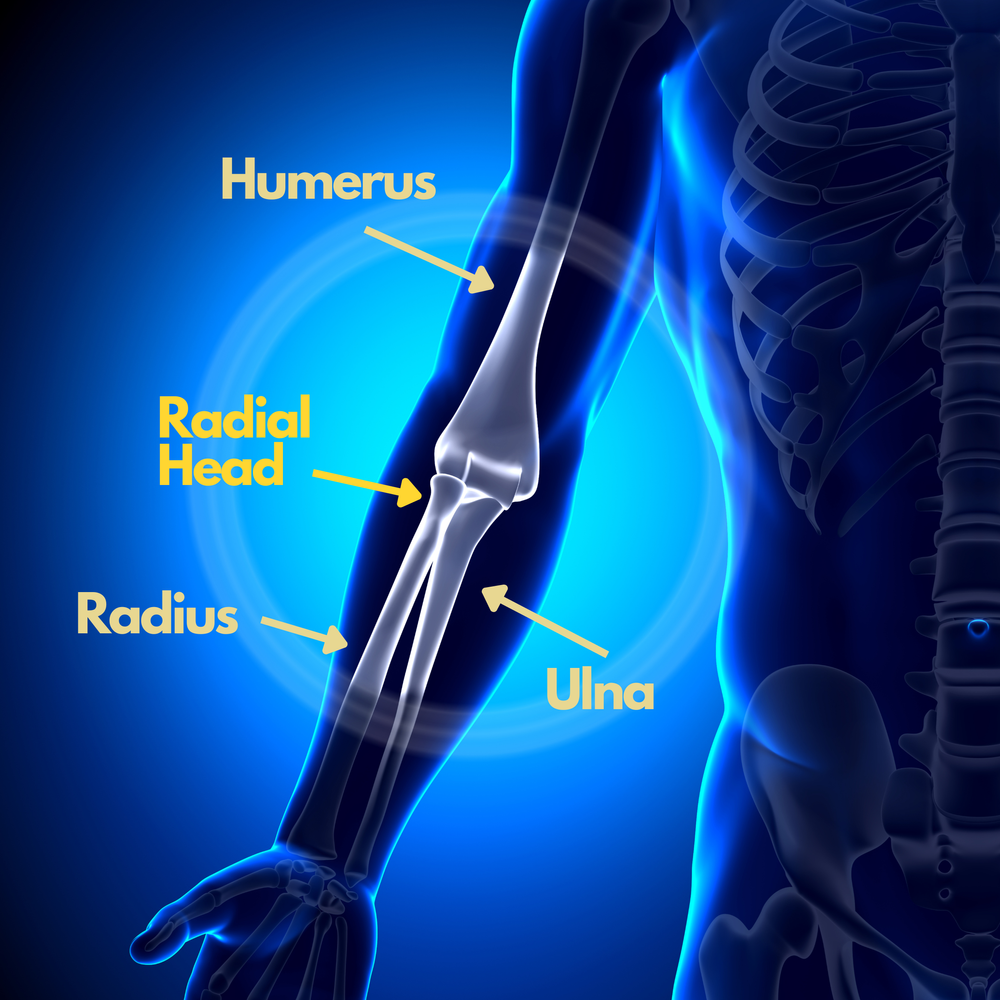 Understanding Radial Head and Neck Fractures: What You Need to Know ...
