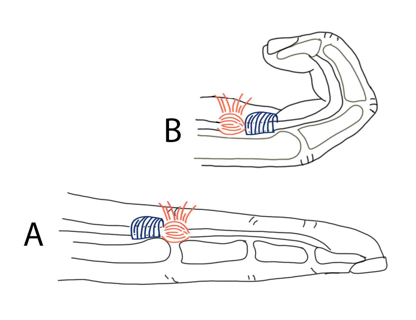 Trigger Finger Steroid Injections: Are They Worth It? — Dr. Nick Golinvaux