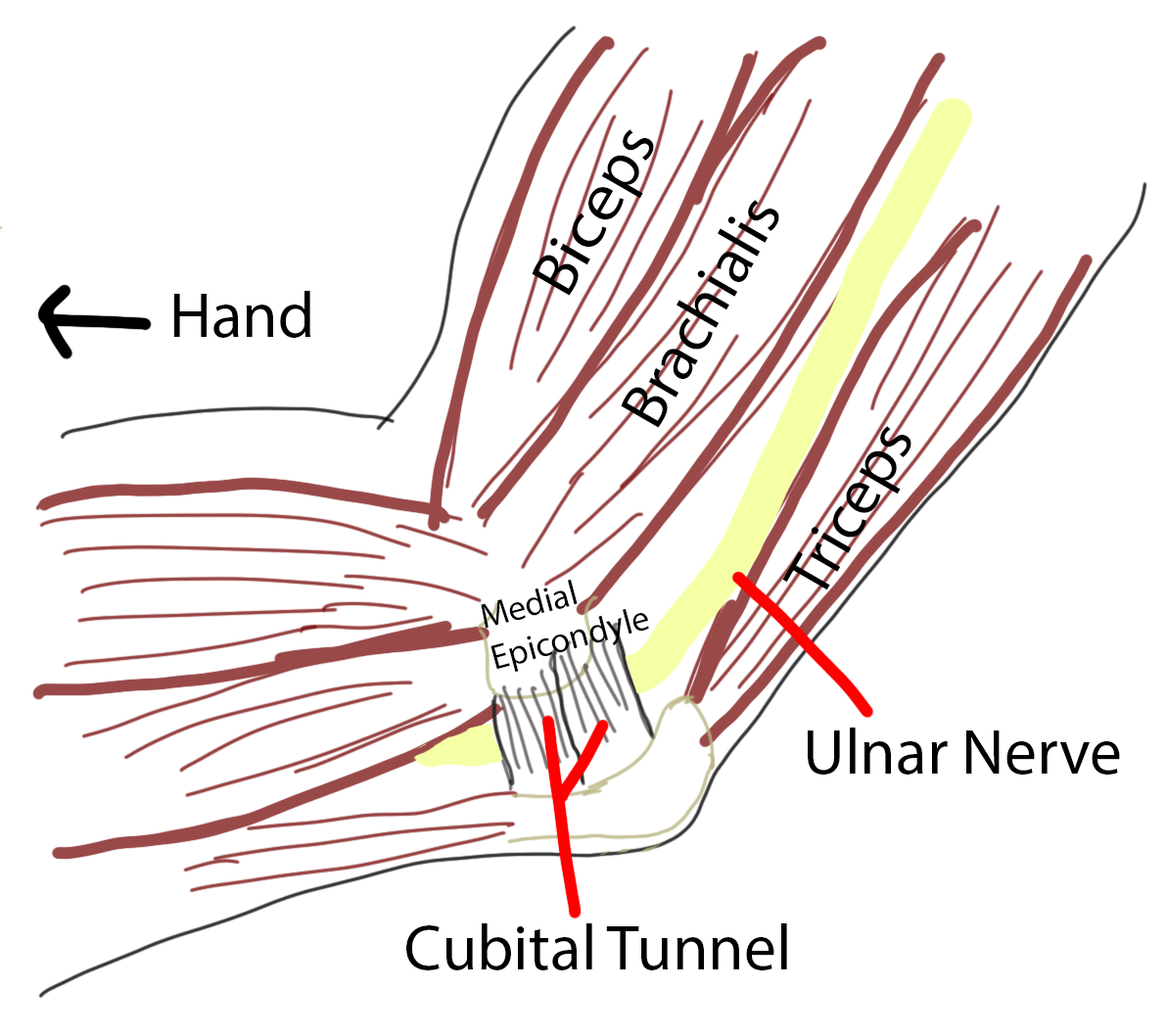 Cubital Tunnel Syndrome (Ulnar Nerve Entrapment) | Denver, Colorado — Dr. Nick Golinvaux