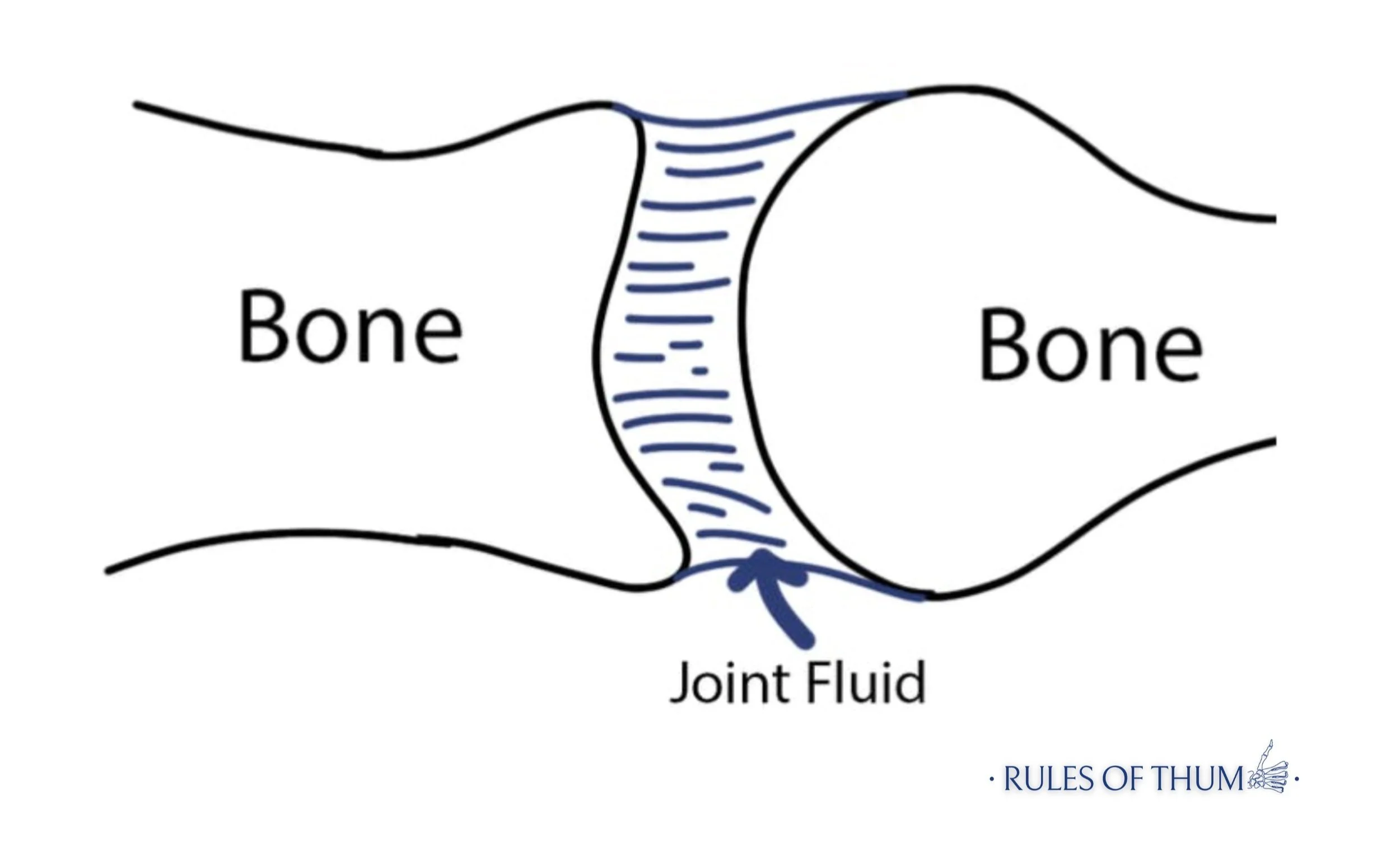 Arthritis: What Does It Actually Mean? — Dr. Nick Golinvaux