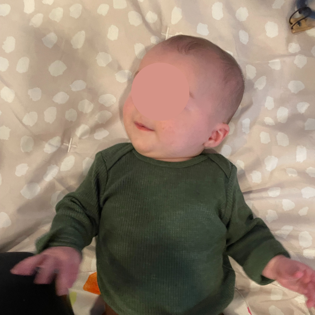 Why Your Baby Always Turns Their Head One Way (and How to Help at Home ...