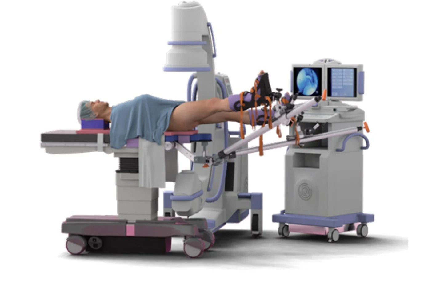 A patient's guide to hip arthroscopy - Egypt دليل المريض لمنظار مفصل ...