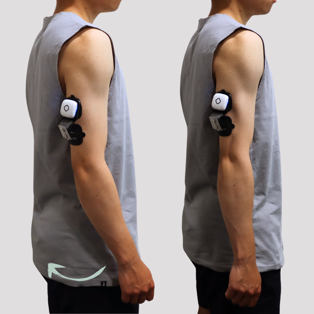 FES Electrode Placements for Upper Limb Stroke Recovery Vol.1 ...