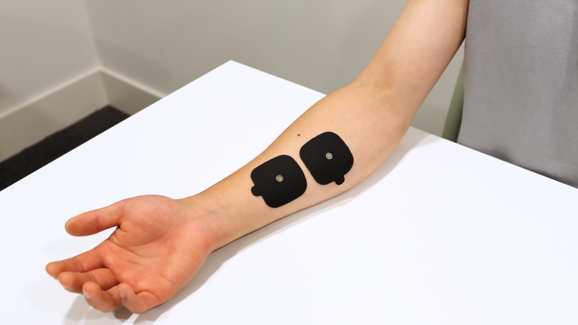 FES Electrode Placements for Upper Limb Stroke Recovery Vol.2 ...