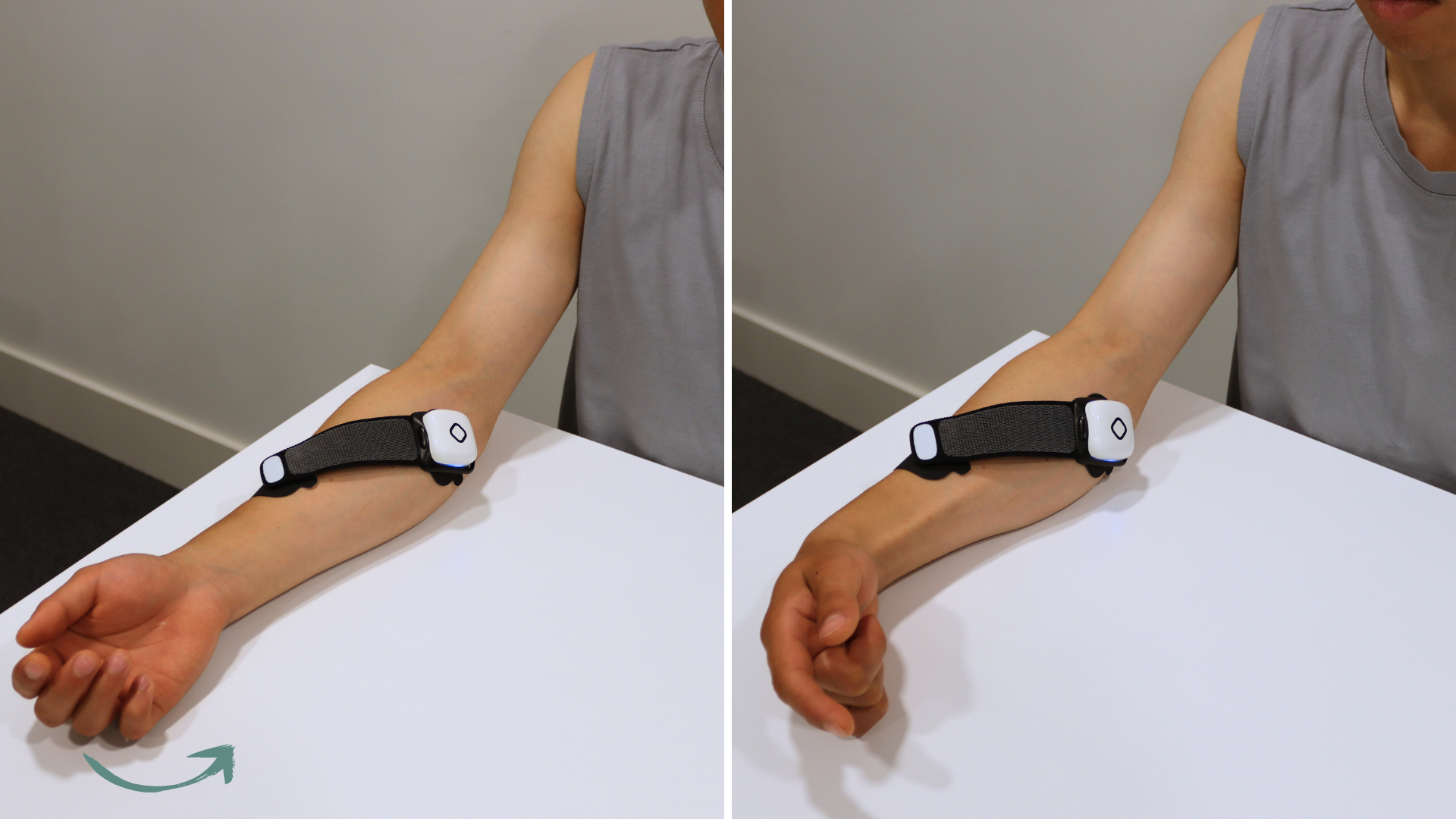 FES Electrode Placements for Upper Limb Stroke Recovery Vol.1 ...