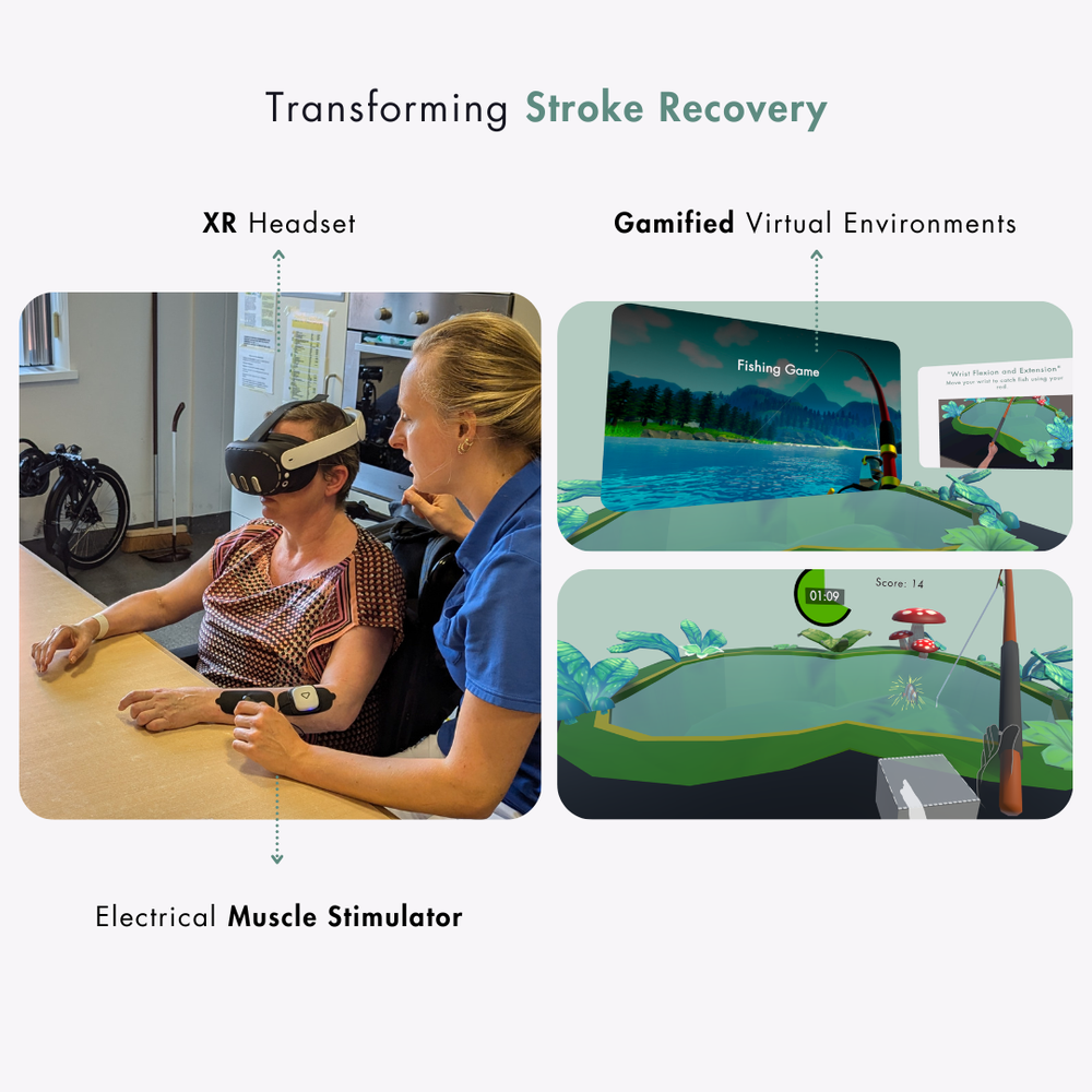 XR Technologies & Stroke Recovery: Revolutionising Rehabilitation for ...