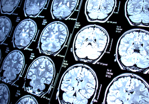 Magnet Therapy: Can Magnets Improve Your Health? — MBODYWORX