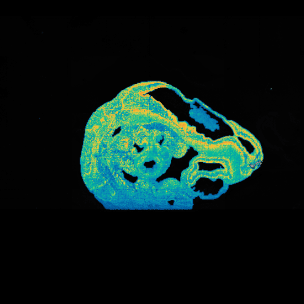 Stereo-seq | Spatial Transcriptomics — Admera Health