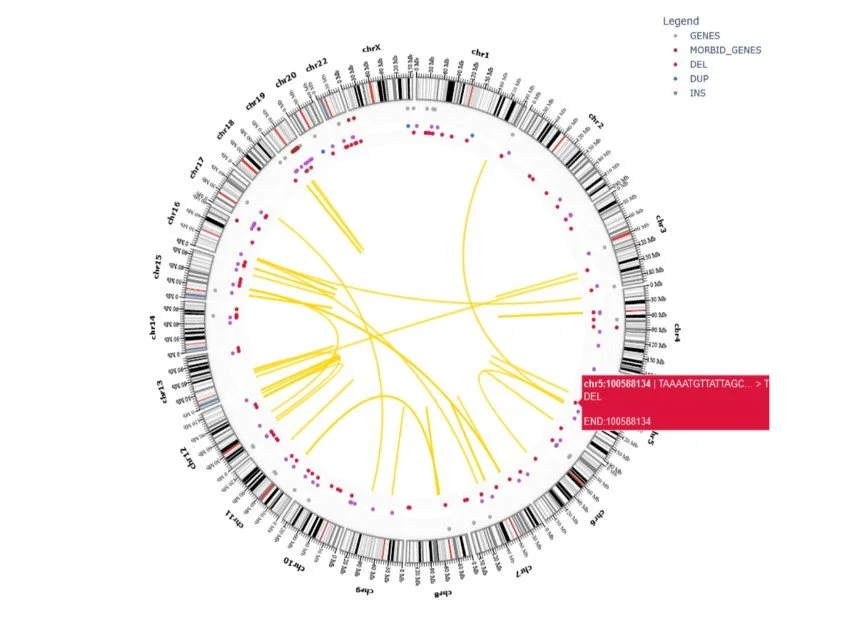 Whole Genome Sequencing: Admera Health's Optimized Workflow — Admera Health