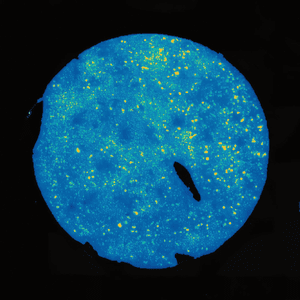 Stereo-seq | Spatial Transcriptomics — Admera Health
