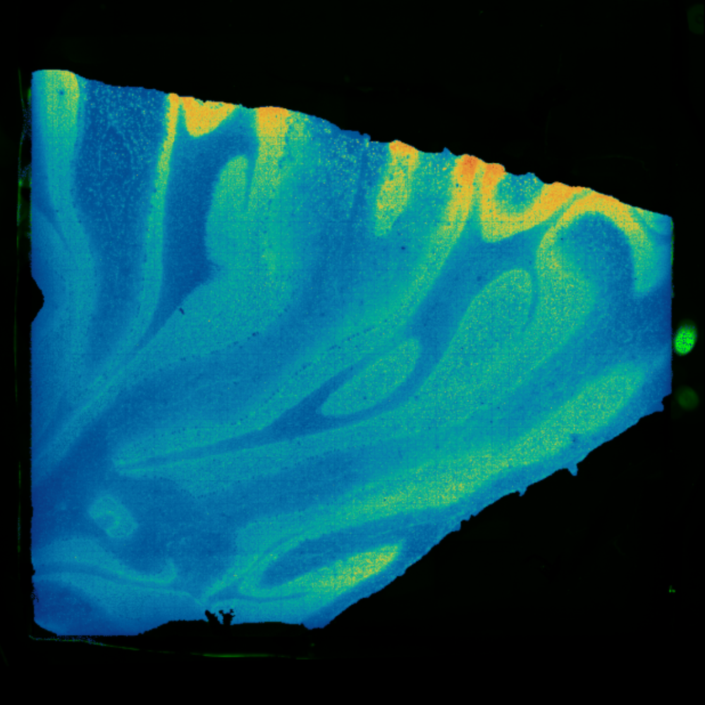 Stereo-seq | Spatial Transcriptomics — Admera Health