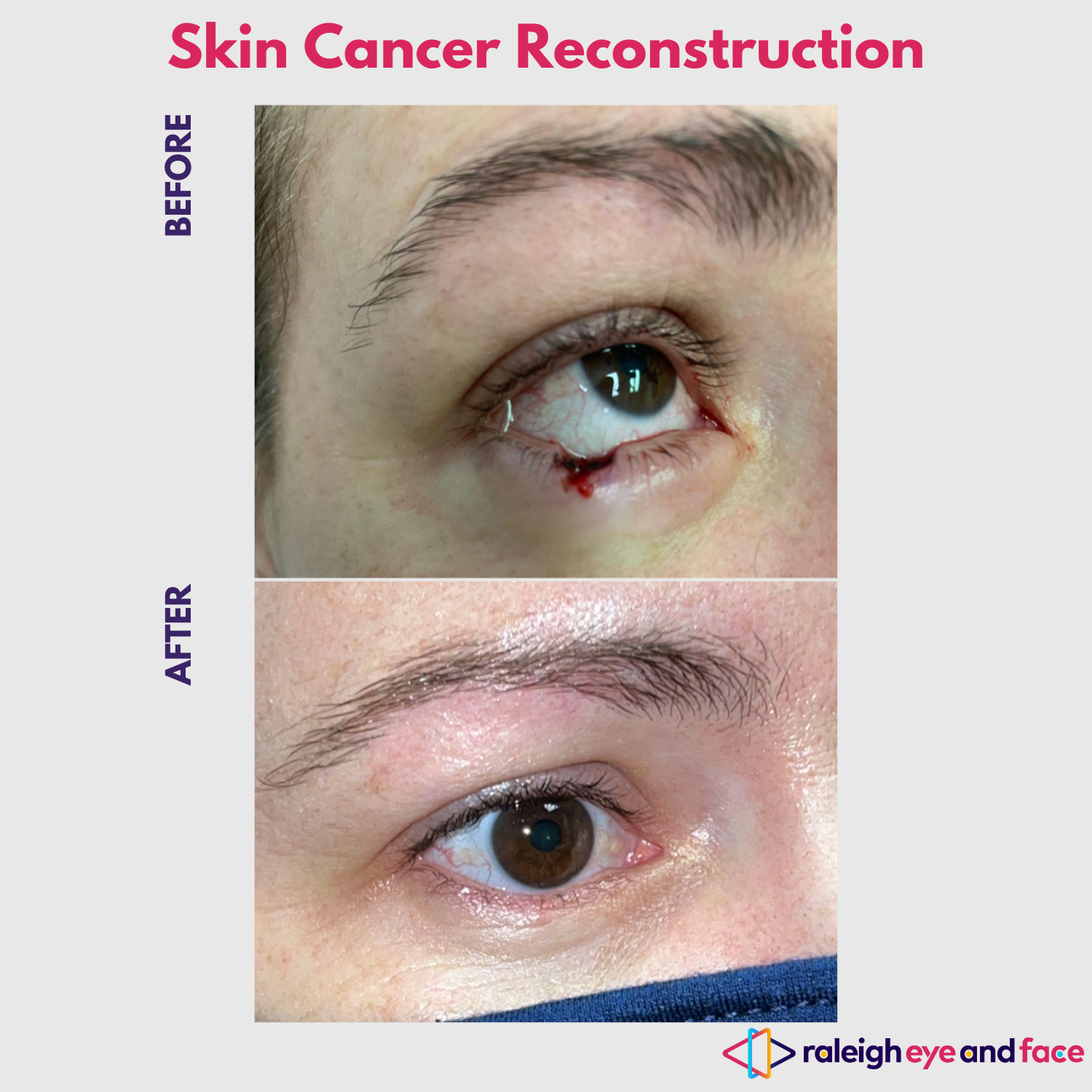 General Gallery — Raleigh Eye and Face