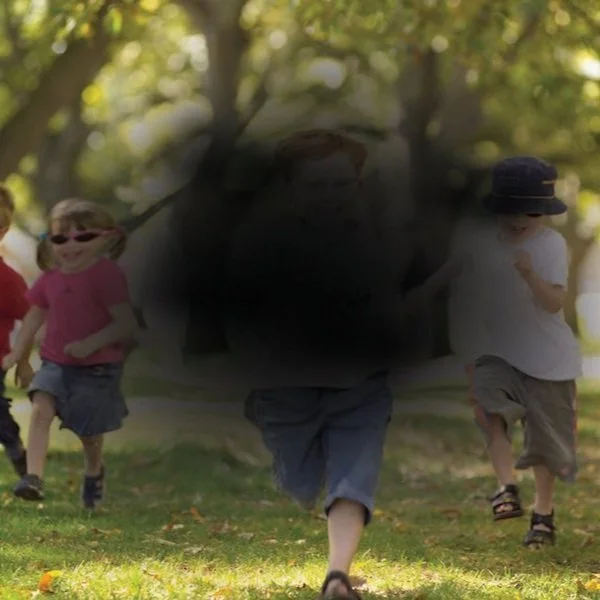 Age related Macular Degeneration AMD Eyre Eye Centre age-related-macular-degeneration-amd-eyre-eye-centre