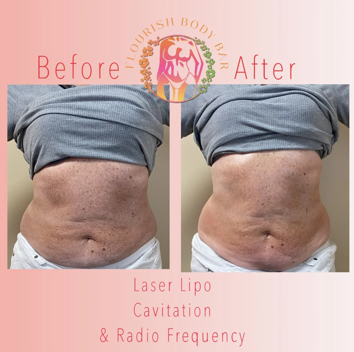Flourish Body Bar