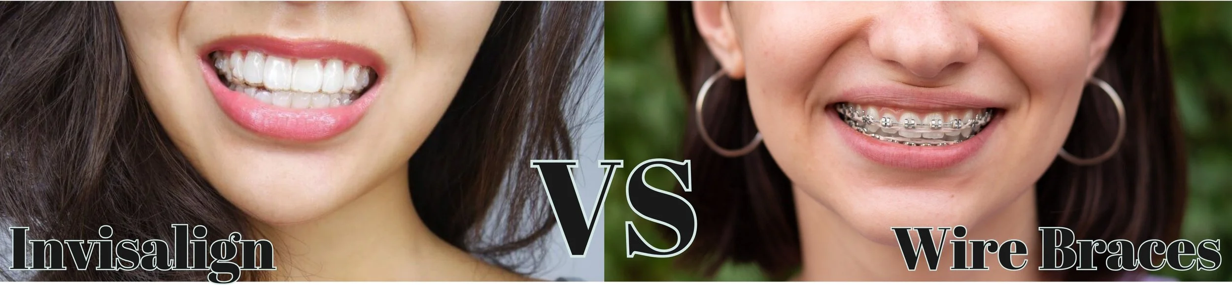 Invisalign Vs Wire Braces — Ligonier Family Dentistry