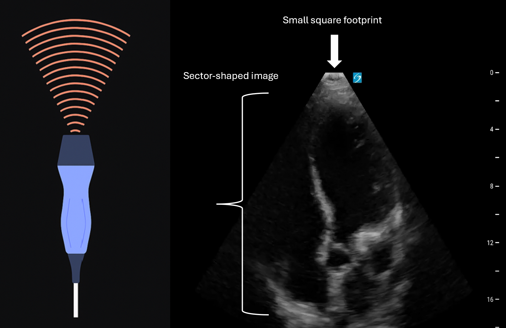 Transducer Types — Pulmonary POCUS