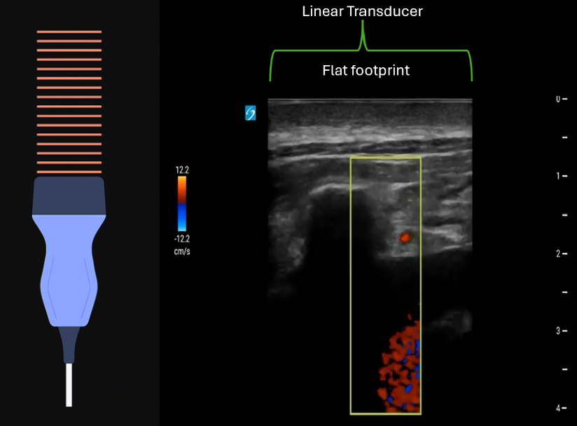 Transducer Types — Pulmonary POCUS