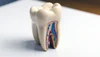 Root Canal Swelling: Symptoms, Causes, and Treatment Explained — Total ...