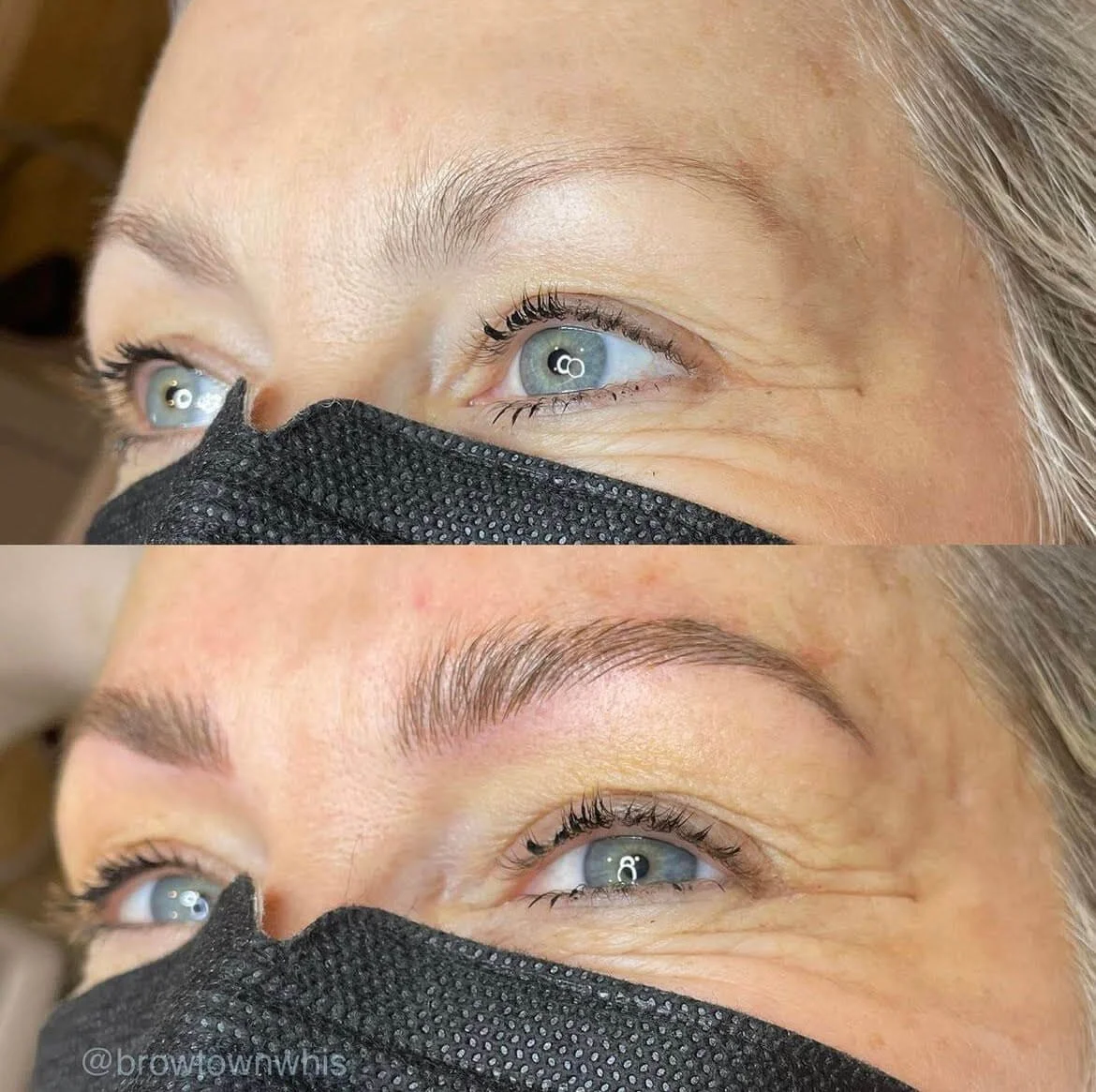Eyebrow Microblading Services — Lionsgate Laser Clinic