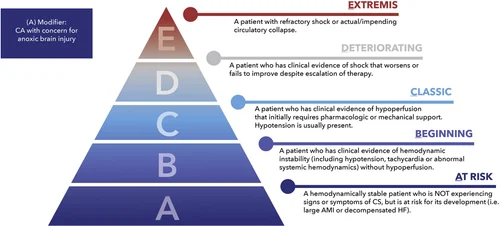 #41 Cardiogenic Shock — Critical Care Time