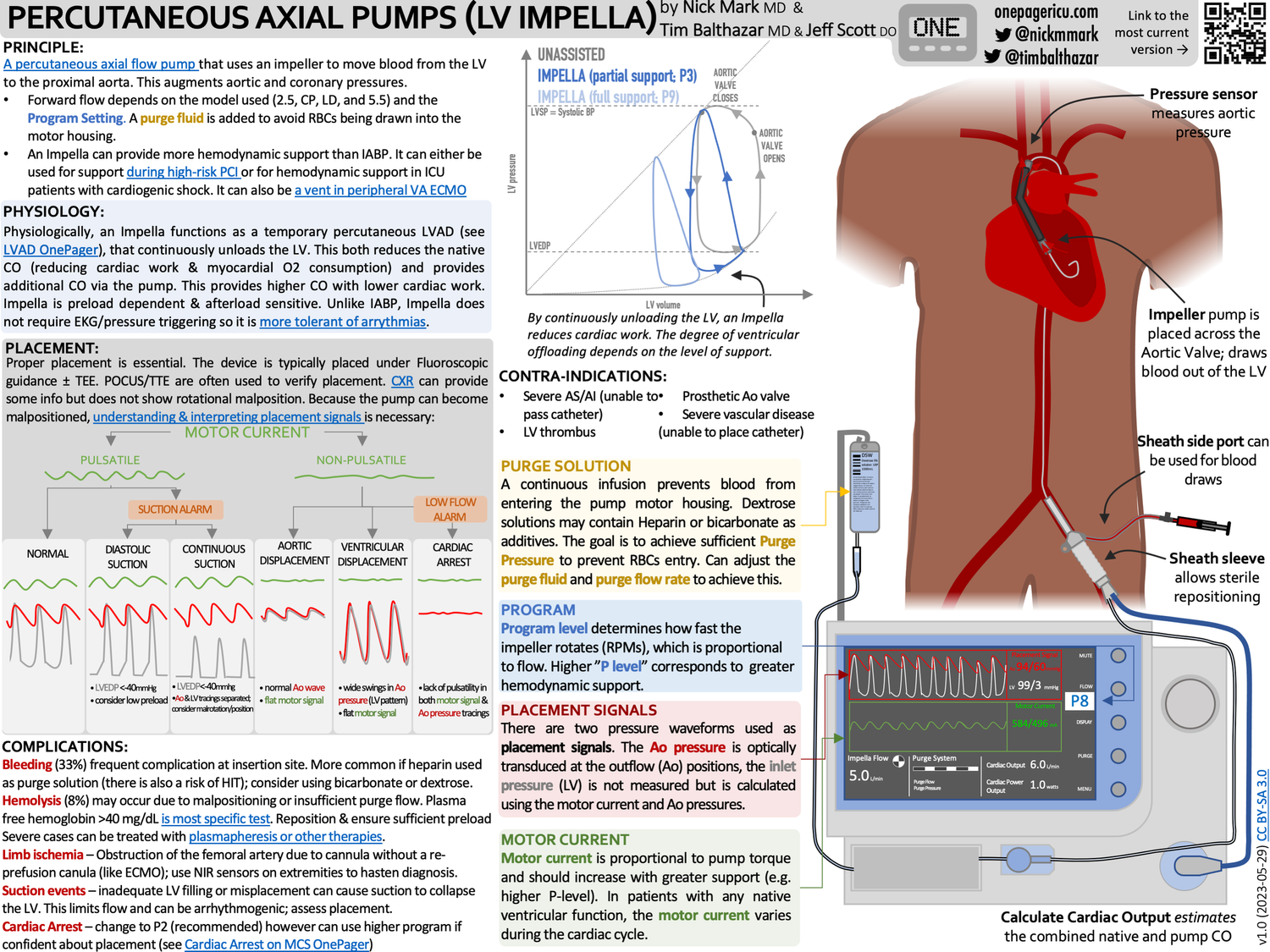 #41 Cardiogenic Shock — Critical Care Time