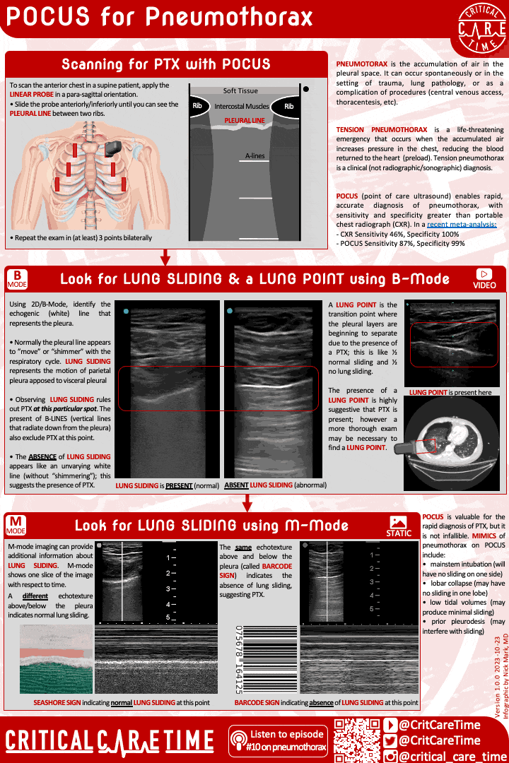 #10 Pneumothorax & Pleural Disease — Critical Care Time