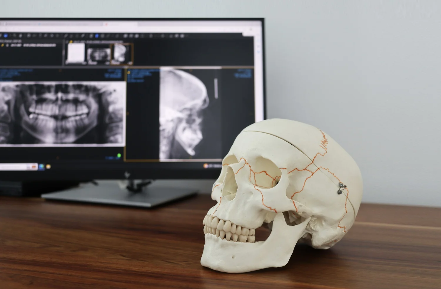 What is Maxillofacial Surgery? — North Coast Maxillofacial Surgery | Dr ...