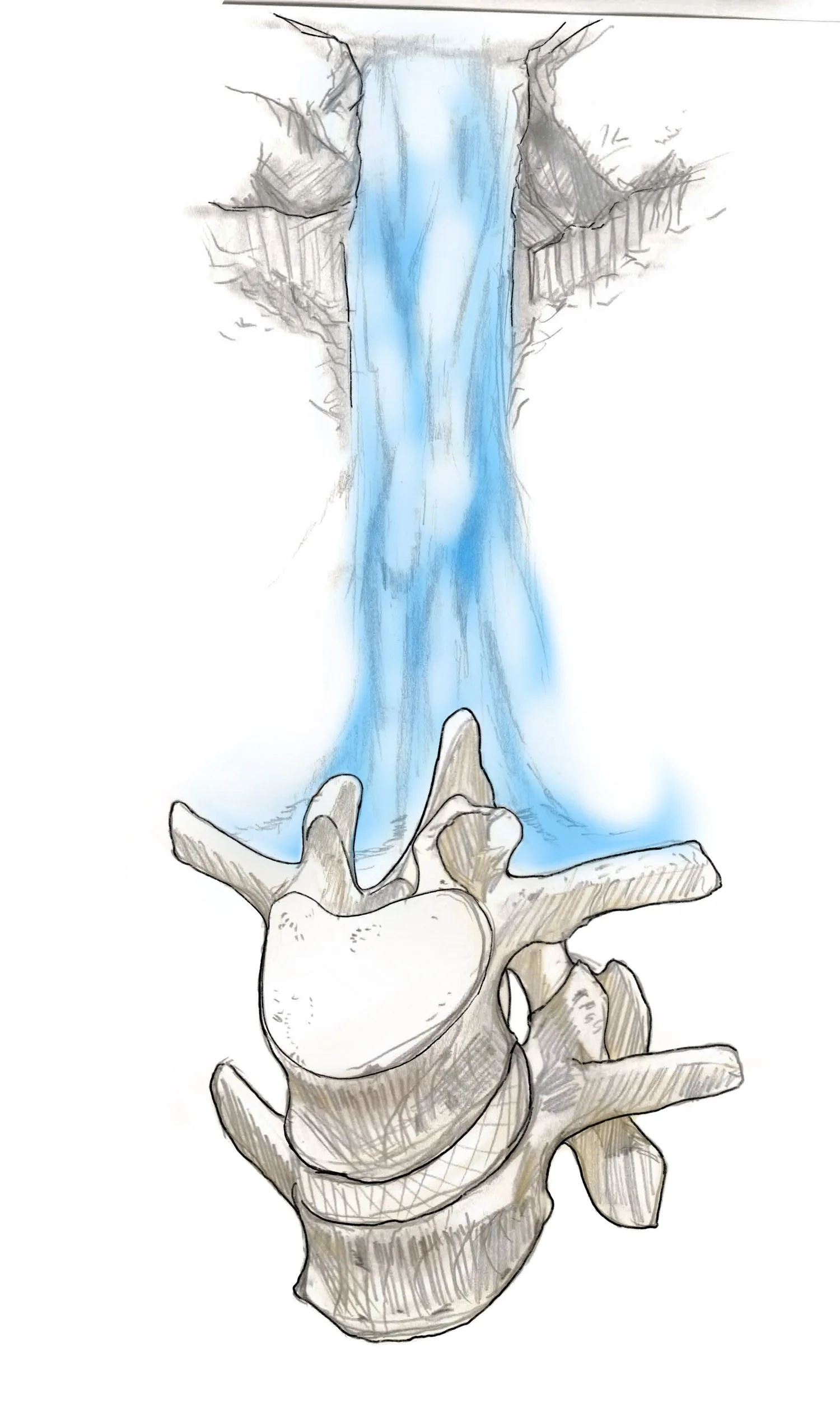 Epidural Steroid Injections (ESI): What Your Surgeon Wants You to Know — Yoshihiro Katsuura MD