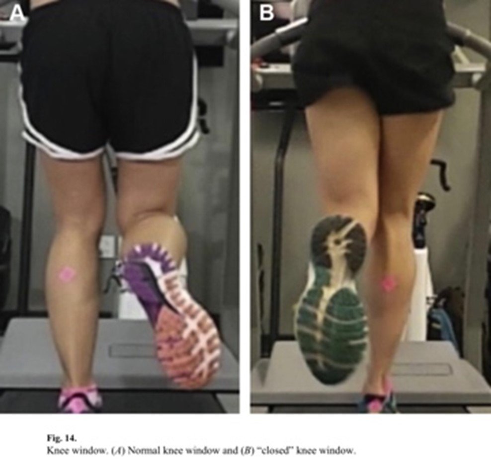 Jannali Physiotherapy & Sports Injury Clinic