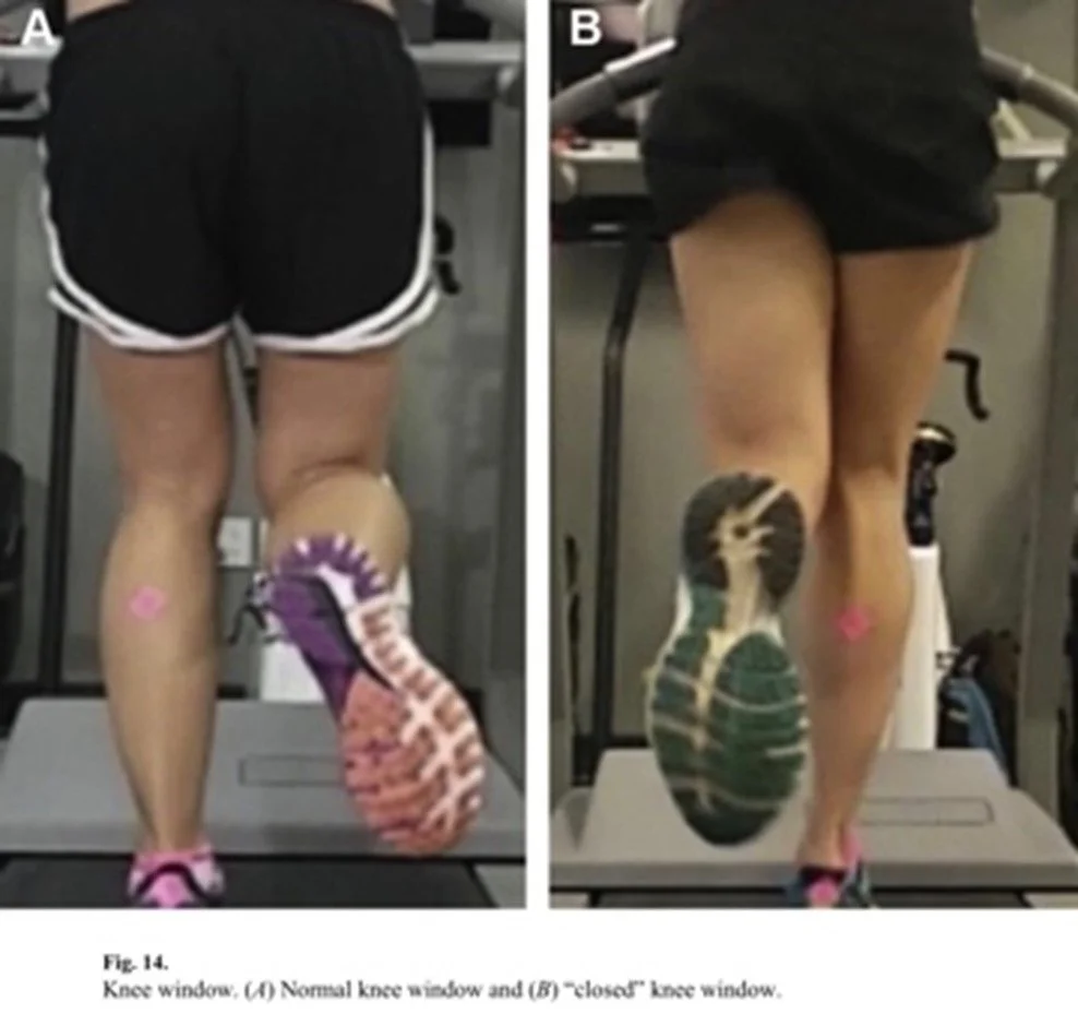 Jannali Physiotherapy & Sports Injury Clinic