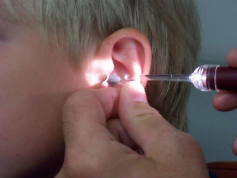 How-To Take an Ear Impression — Hocks Hearing Healthcare Products