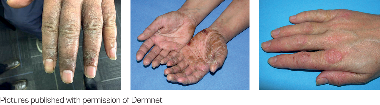 Zematane Landing Page