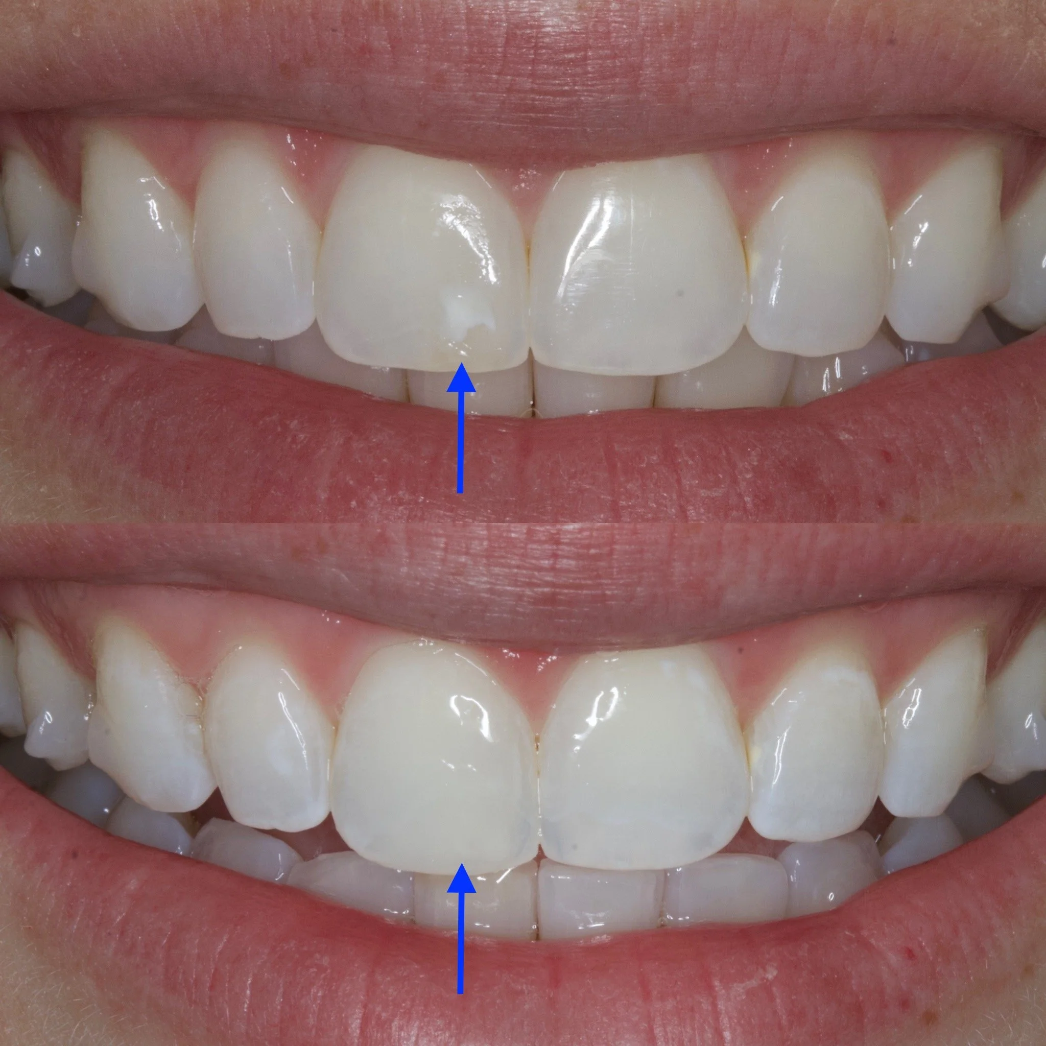 Before and After | Cosmetic Dentist, Aesthetic Specialist & General ...