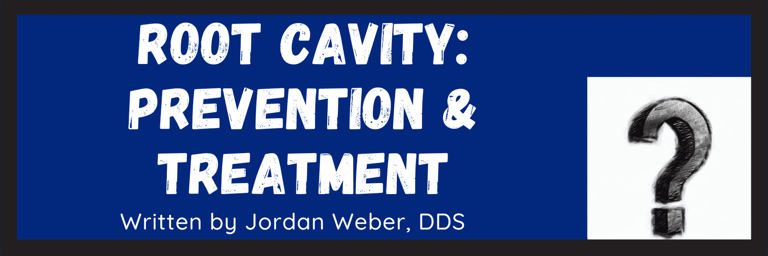 Root Cavity: Prevention & Treatment — Burlington Dental Center