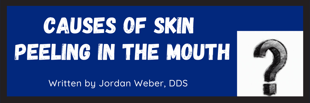 Causes of Skin Peeling in the Mouth [Answered!] — Burlington Dental Center