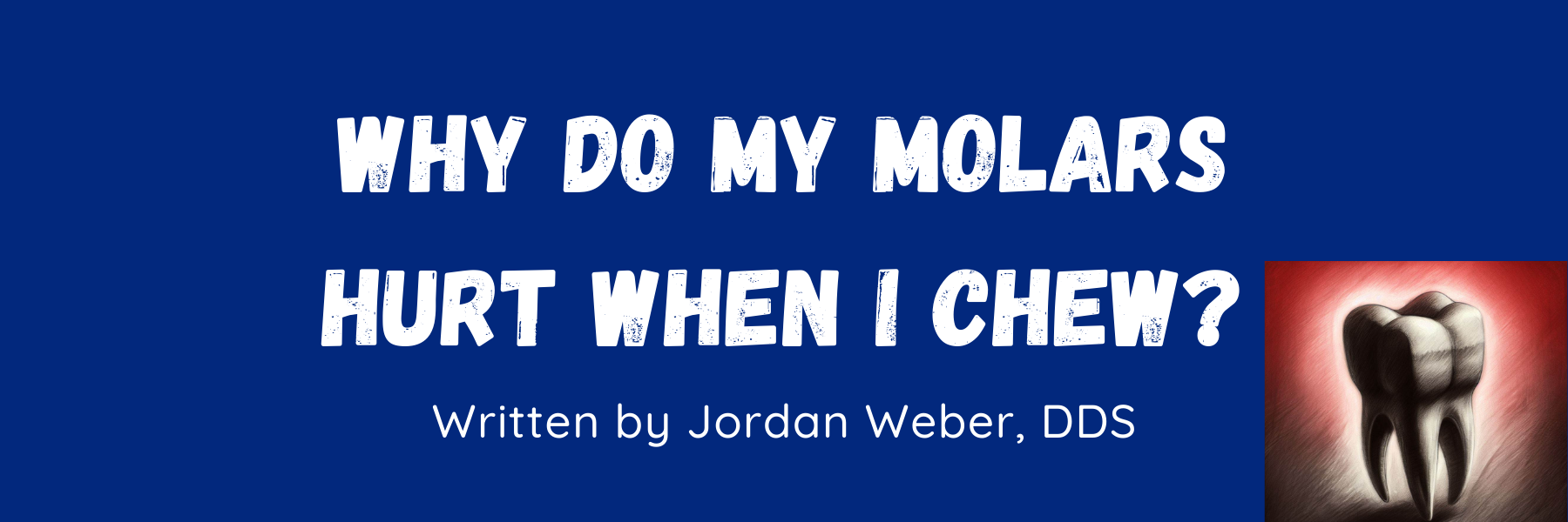 Why Do My Molars Hurt? — Burlington Dental Center