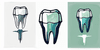 Jaw Pain After Tooth Extraction [Causes & Treatment] — Burlington ...
