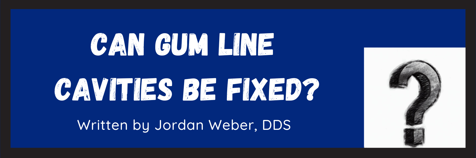 Gum Line Cavity: How Do They Fix a Cavity on the Side of the Tooth ...