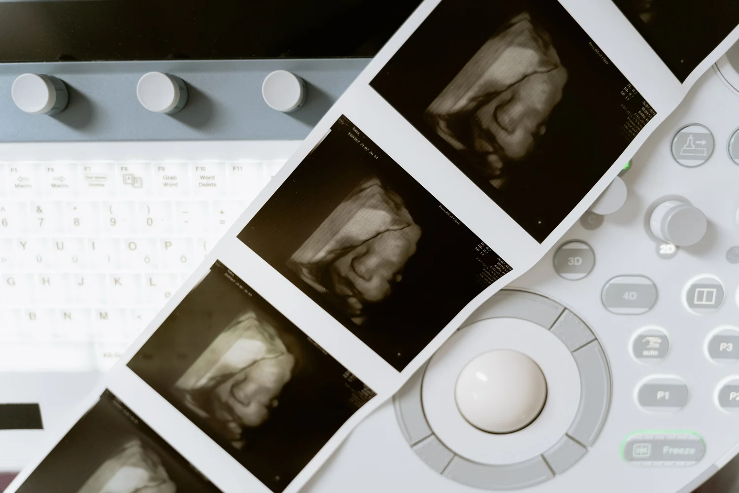 For Providers — Elite Ultrasound Imaging | 3D/4D, OB/GYN, General or ...