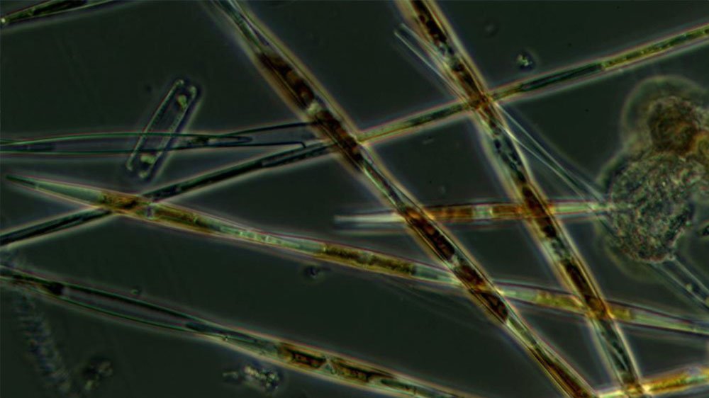 Domoic Acid | Channel Islands Marine & Wildlife Institute | CIMWI