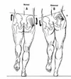 What Does A Misaligned Pelvis Feel Like?