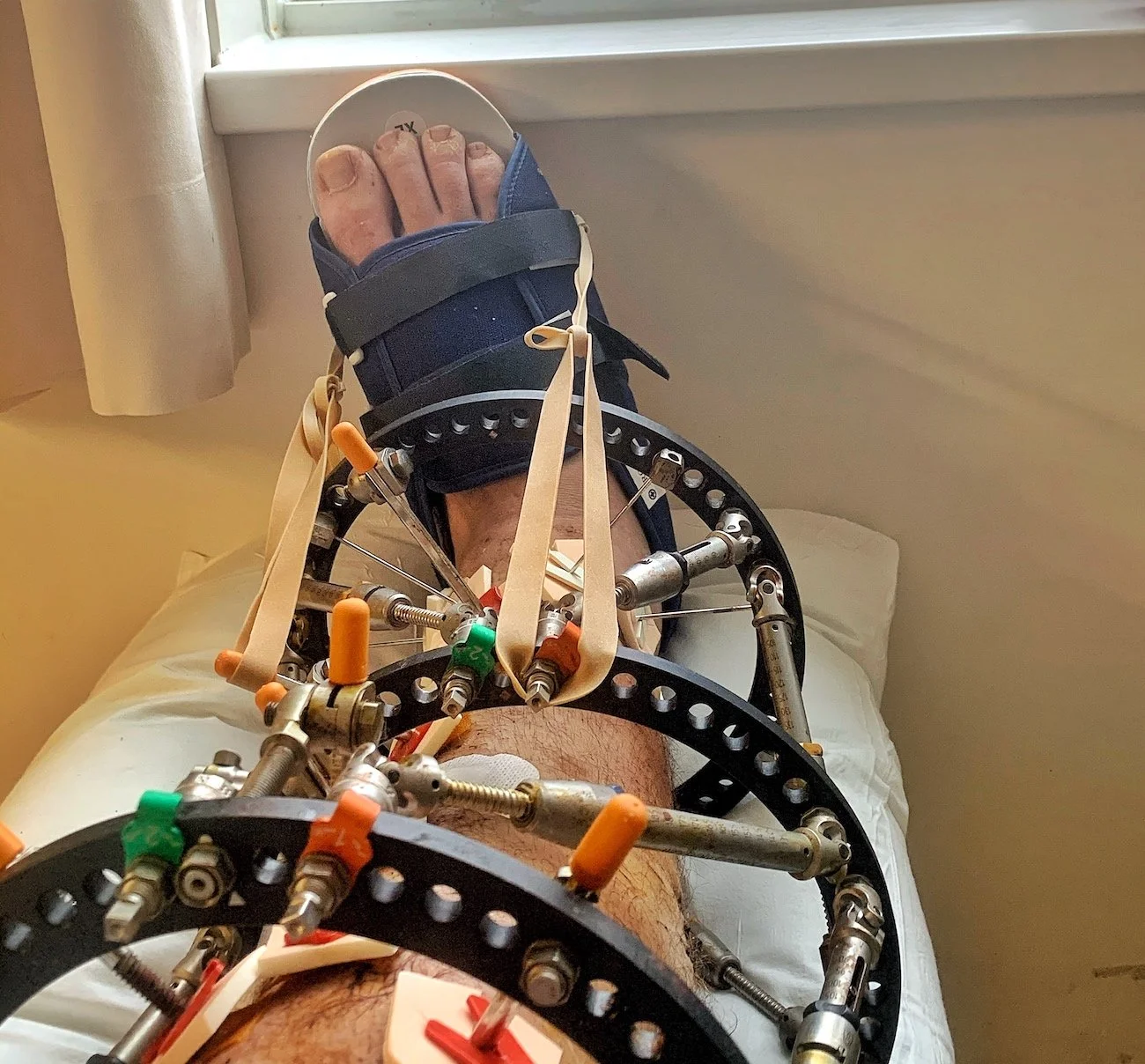 Matterhorned: the home phase of my recovery — Tales of Adventure - by ...