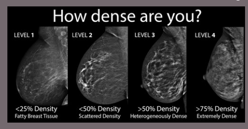 Breast Cancer Screening Patient Resources — Operation Breast Density