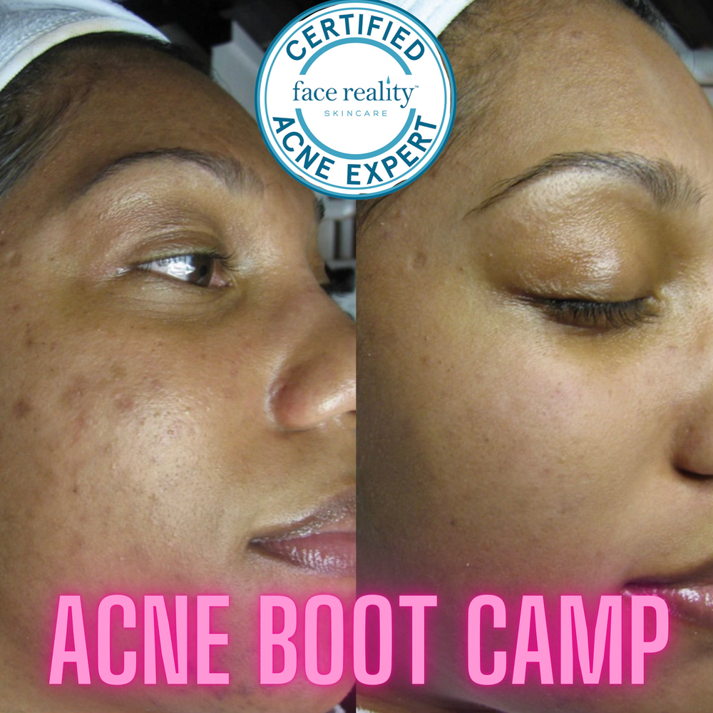 Sugaring Hair Removal 100% Organic In Cooper City Florida