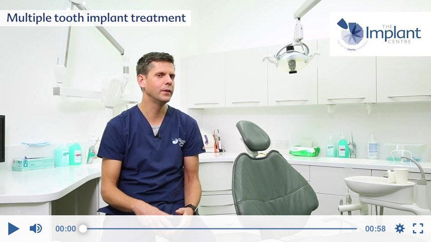 Dental Implant Options