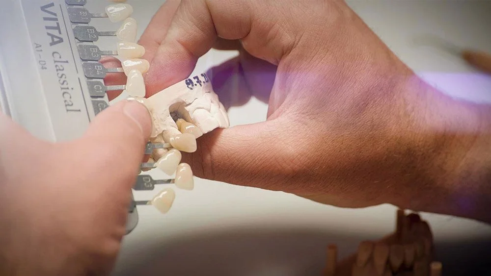 Why Choose Us? - The Implant Centre