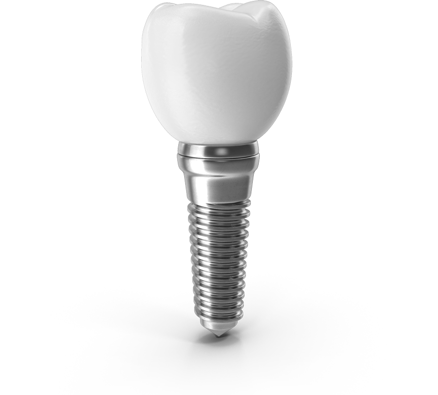The Implant Centre | Dental Implants