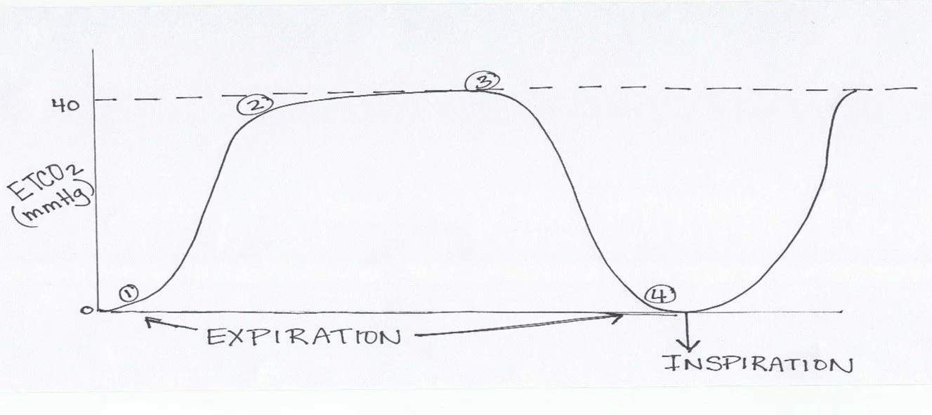 Technician’s Guide to Capnography — VETERINARY ANESTHESIA NERDS