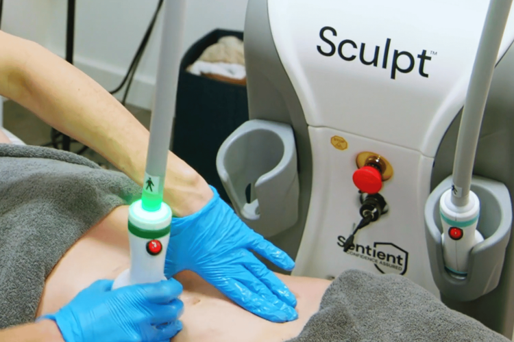 SENTIENT® SCULPT™ | Body Contouring — you+ Medical Aesthetics: Med Spa ...